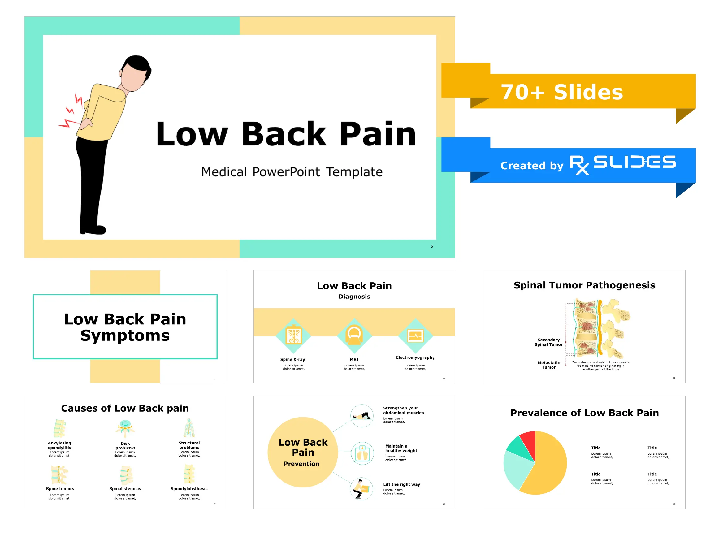 Download Low Back Pain PowerPoint Template|RxSlides